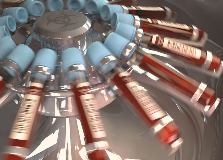 Mixture Separation Techniques (Theory) | Secondaire | Alloprof